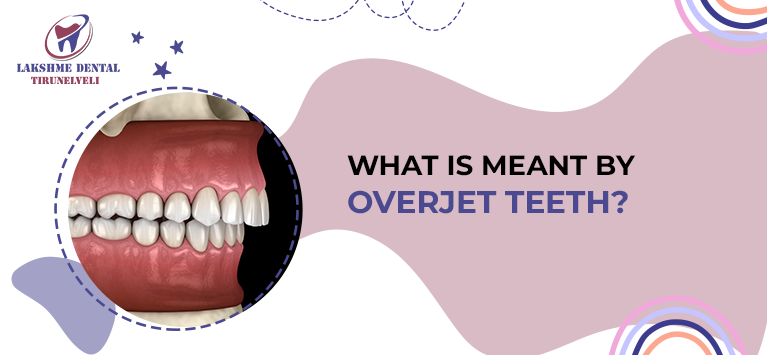 Overbite Vs Normal Bite Differences Causes And Treatment 41 Off